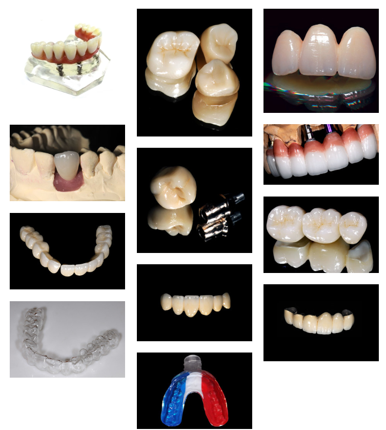 Gallery | Dental Lab in Annandale, VA